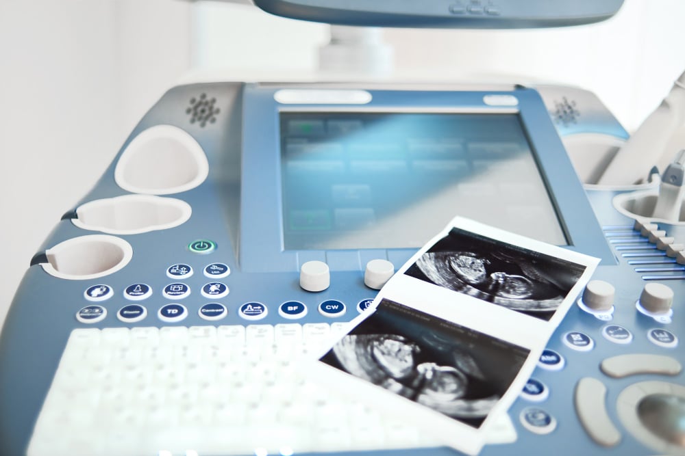 Ultrasound CPT Codes: A Complete Guide for Providers